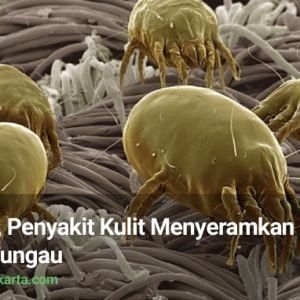 Scabies, Penyakit Kulit Menyeramkan Akibat Tungau | FUMIDA